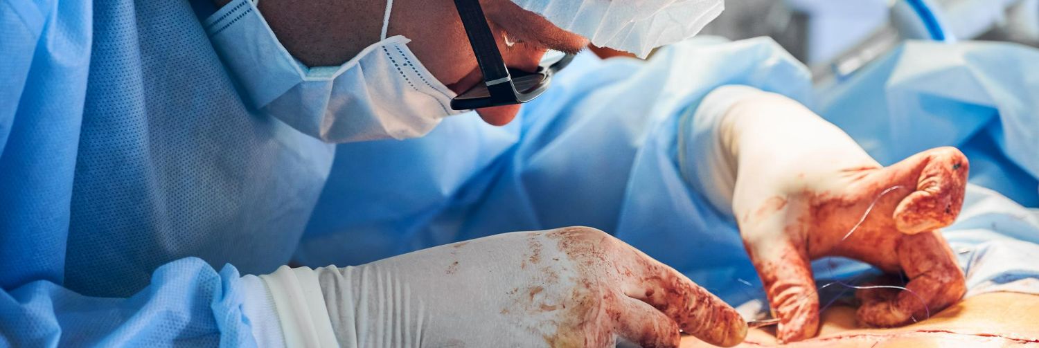 What is Vascular Surgery - Mount Multispeciality & Superspeciality ...